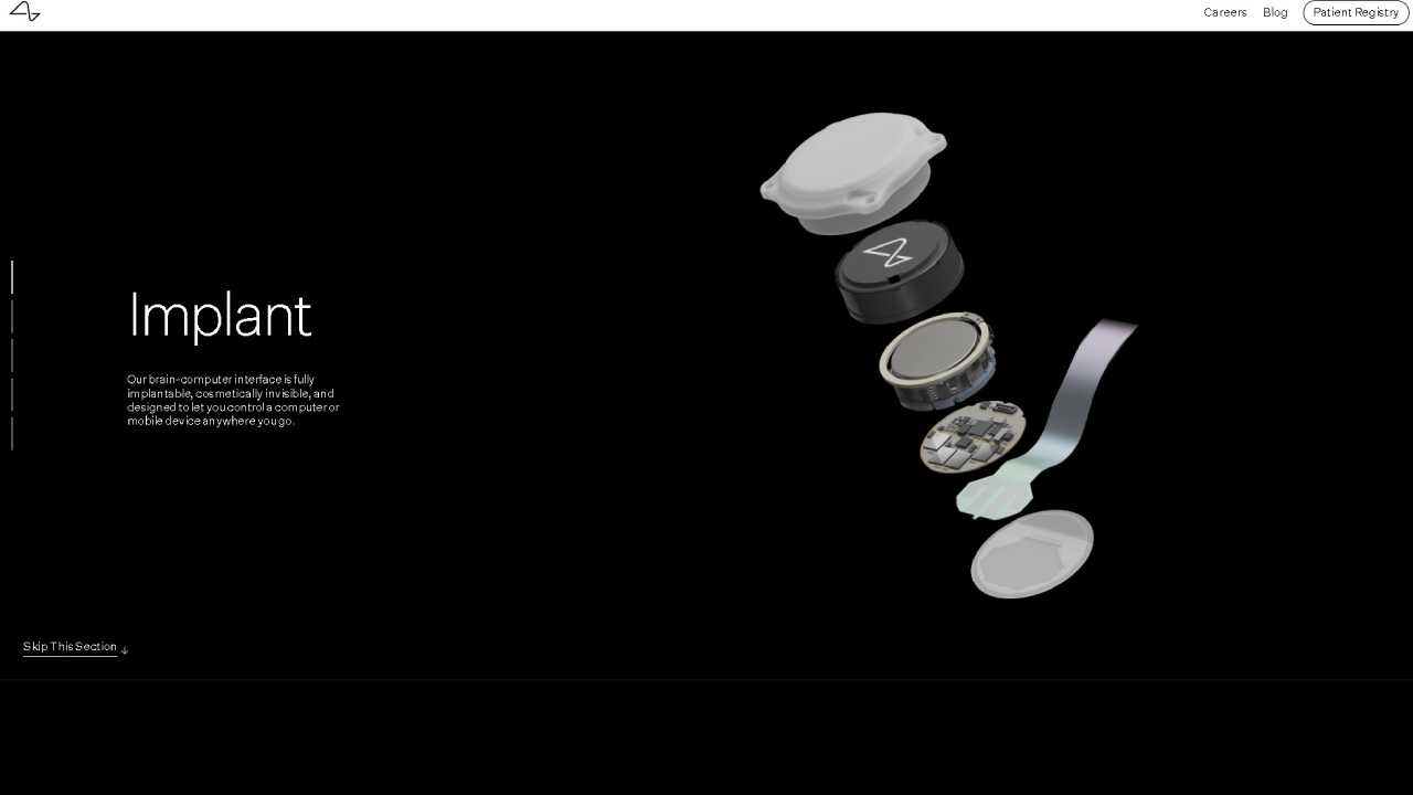 Neuralink dispositivo interconexión cerebral - Delfos tecnoblog de ...